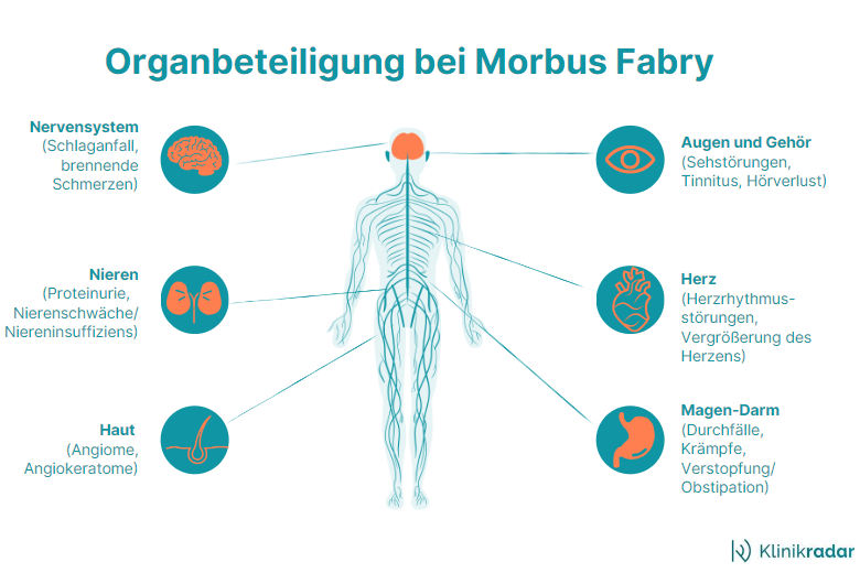 Verschiedene Organe und Körpersysteme können bei Morbus betroffen sein ...
